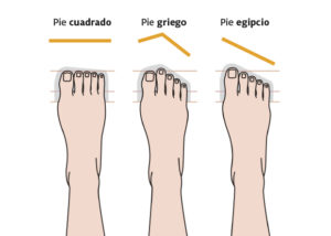 Tipos de pies, ¿cuáles son los tuyos y cómo influyen en tu pisada ...